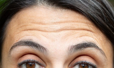 How to Reduce and Prevent Frown Lines