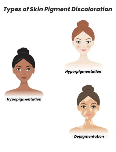 Hyperpigmentation vs. Hypopigmentation: Understanding the Differences