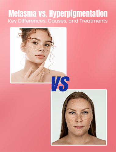 Melasma vs. Hyperpigmentation: Key Differences, Causes, and Treatments